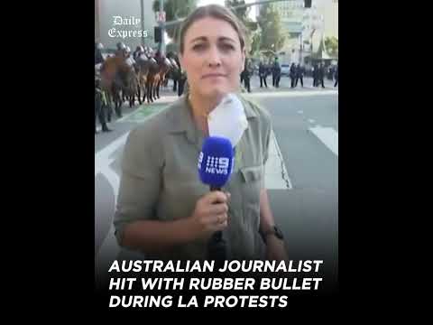 AUSTRALIAN JOURNALIST HIT WITH RUBBER BULLET DURING LA PROTESTS
